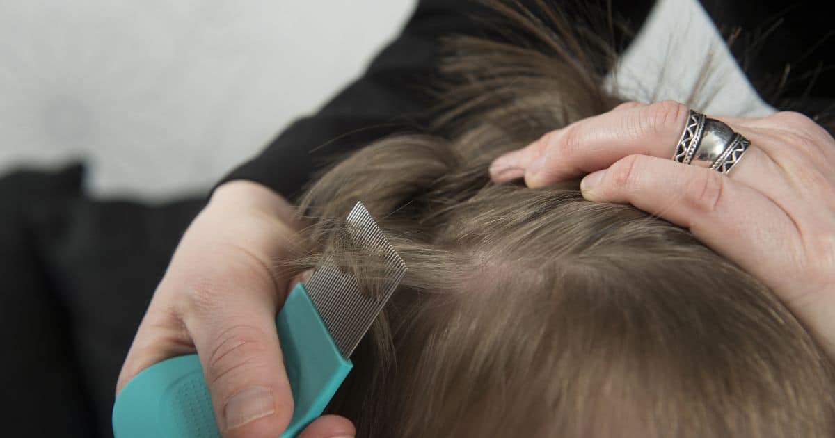 Effective Methods for Removing Dead Lice Eggs from Hair